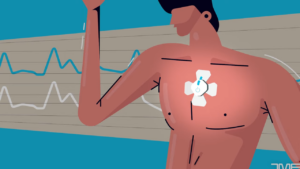 What is DTx? Benefits and Possibilities